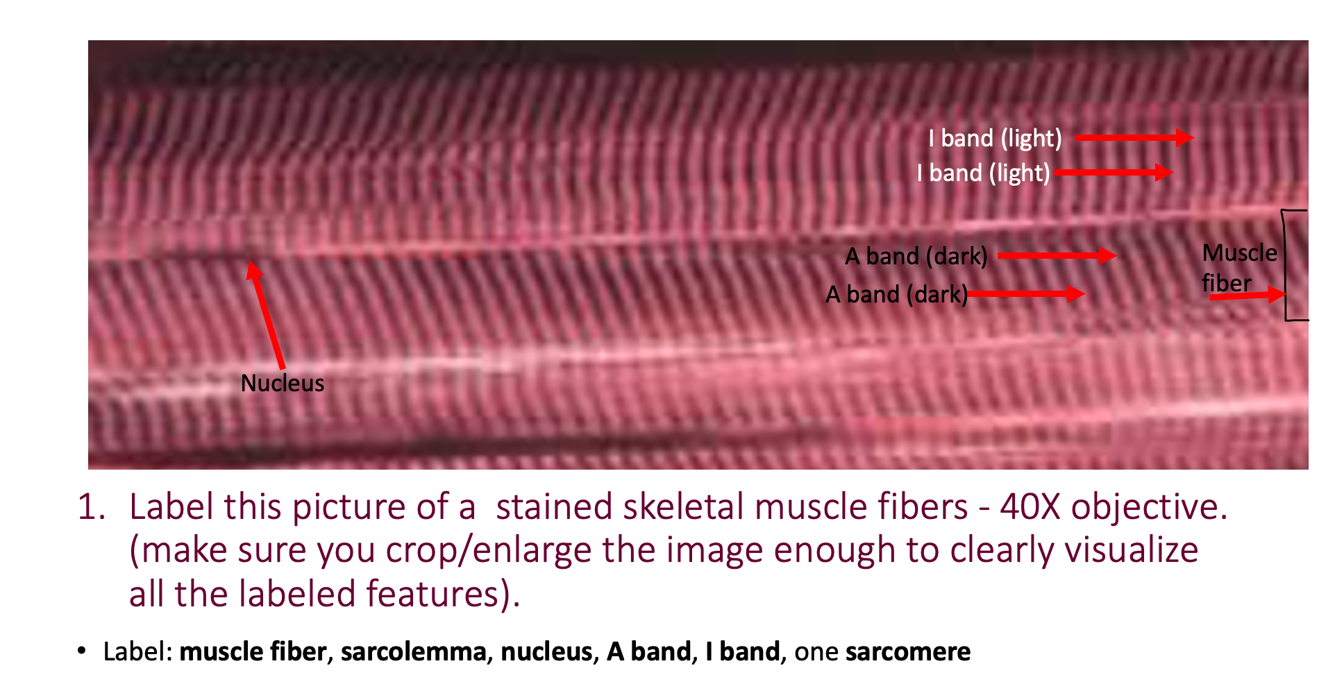 Solved Where is the sacromere and sacrolemma located? And | Chegg.com