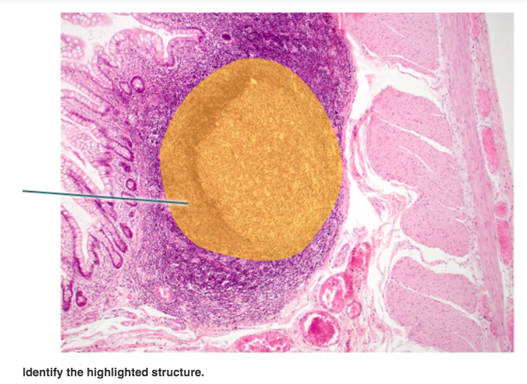 Solved Which structures are highlighted? Identify the | Chegg.com