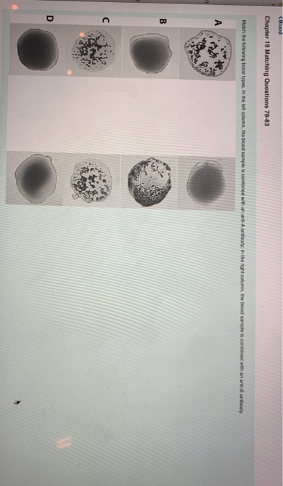 Solved Chapter 19 Matching Questions 78-83 Match the | Chegg.com