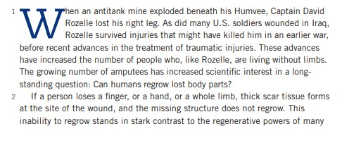 Read “Can Lost Limbs Grow Back?” and apply the SQ3R | Chegg.com