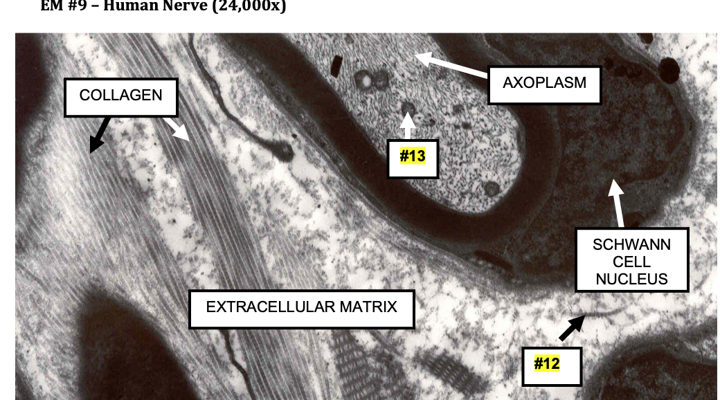Solved EM #9 - Human Nerve (24,000x) AXOPLASM COLLAGEN #13 | Chegg.com