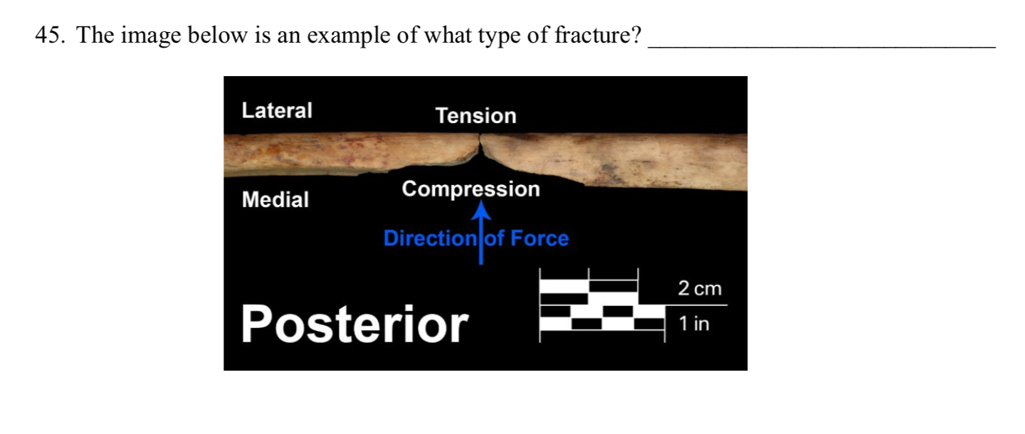 Solved 41. Regarding the Fully method for stature | Chegg.com