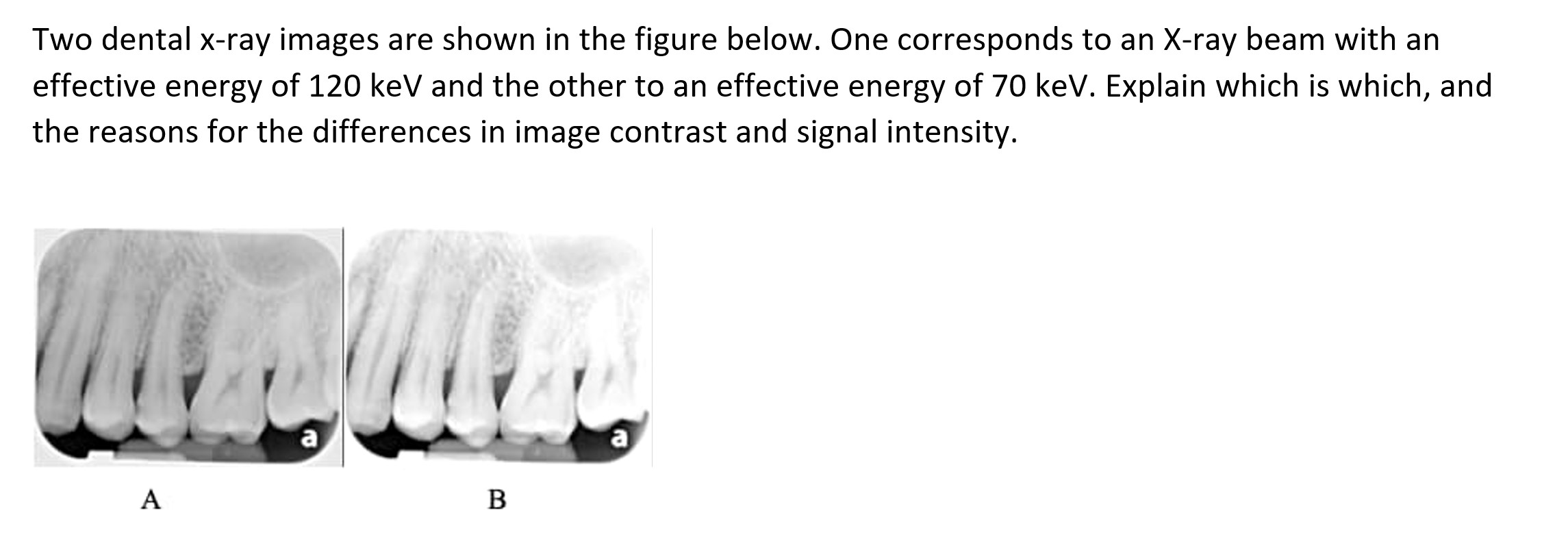 Solved Two Dental X Ray Images Are Shown In The Figure