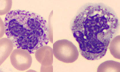 Alder Reilly Anomaly