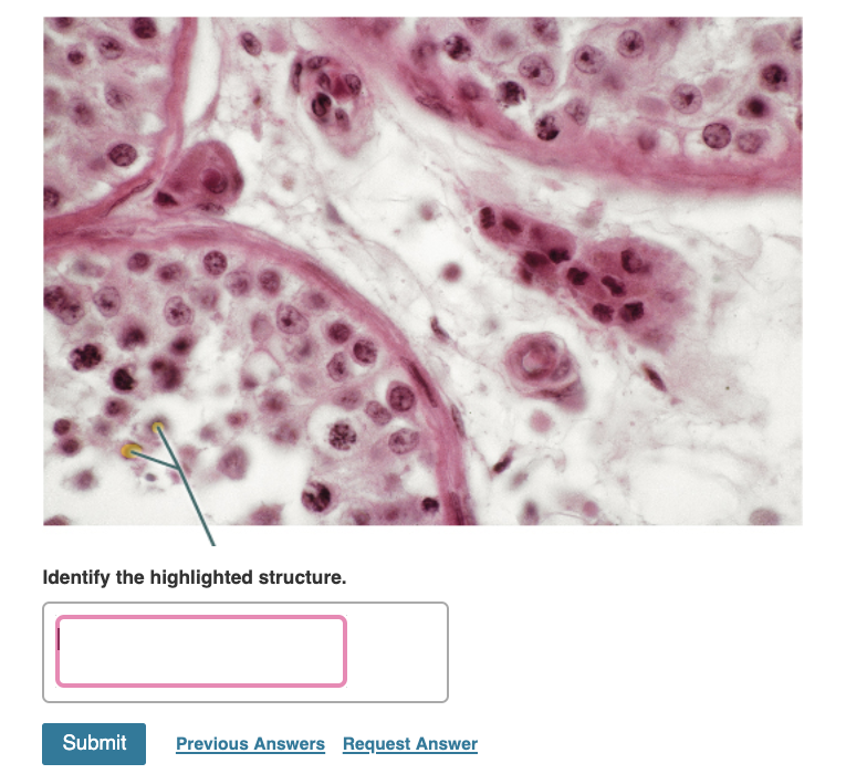 Solved De LT-H11: Male Pelvis, 2-part, 3 Scientific The | Chegg.com