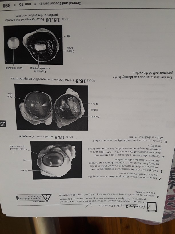 Solved Procedure 2 Eyeball Dissection In this exercise you | Chegg.com