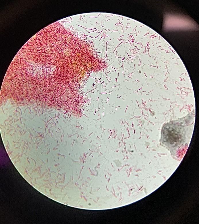 Solved Based on the given image and positive Citrate test, | Chegg.com