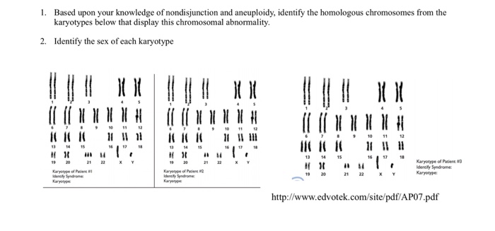 Solved . Based upon your knowledge of nondisjunction and | Chegg.com