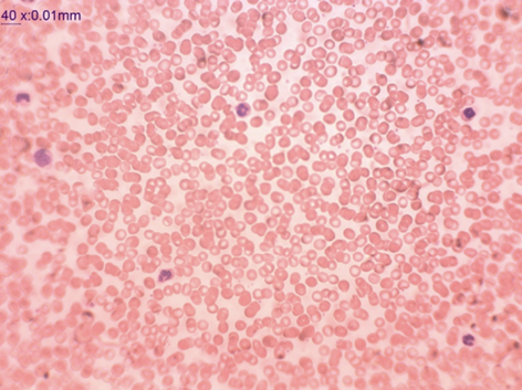 Solved Based on the image given, please label the blood | Chegg.com