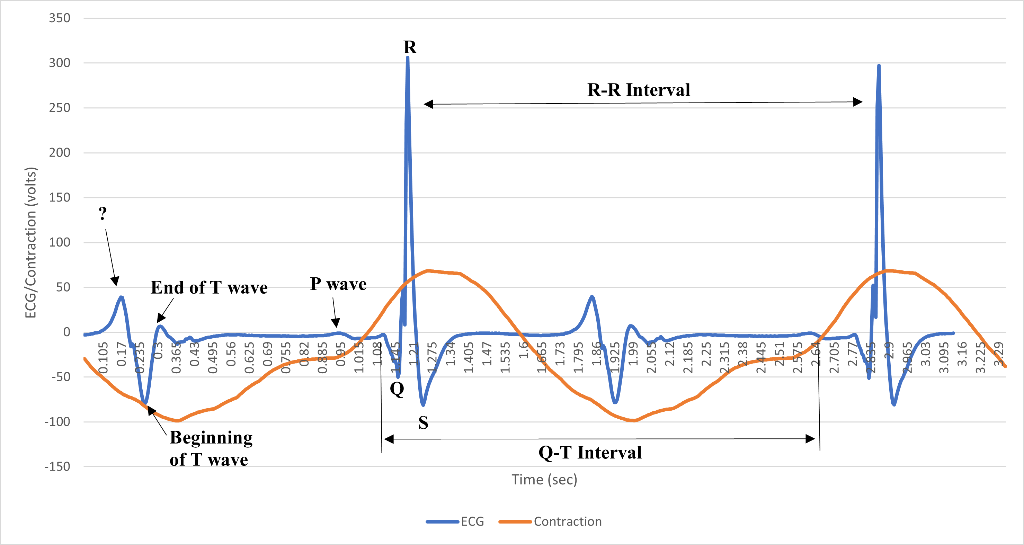 Solved This is a Frog ECG please help me check if I am | Chegg.com
