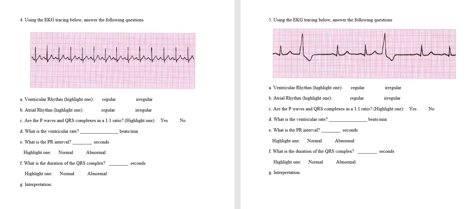 Solved 4. Using the EKG tracing below, answer the following | Chegg.com
