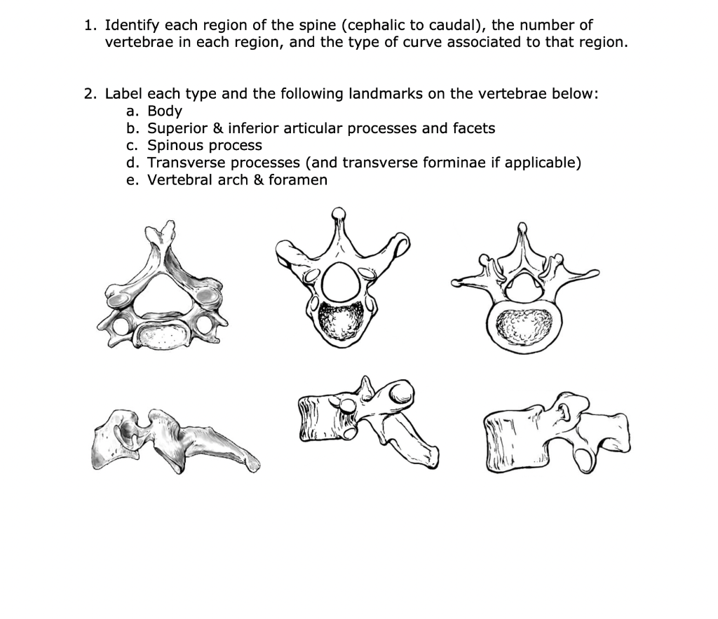 Solved 1. Identify each region of the spine (cephalic to | Chegg.com