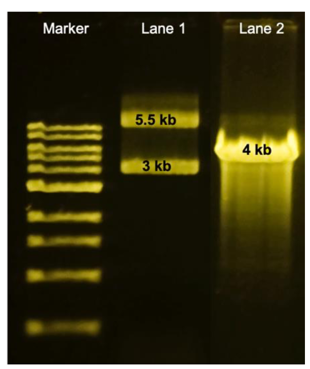 Solved 11. If Lane 1 contains undigested plasmid DNA and | Chegg.com