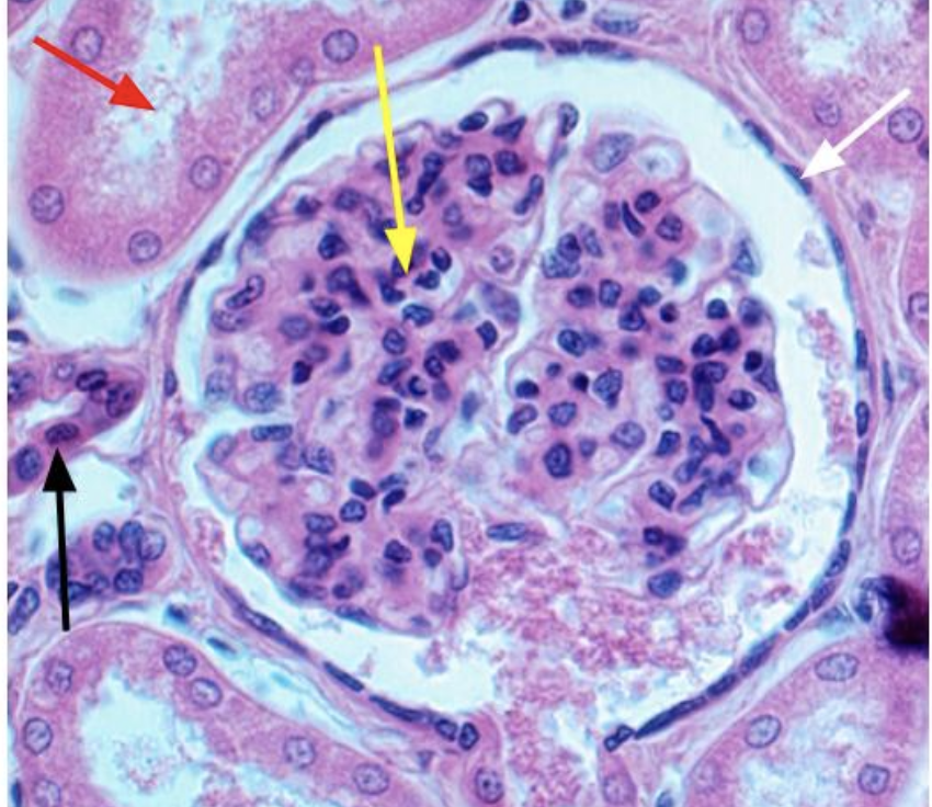 Solved 1. What is the name of the bi-nucleated cell? | Chegg.com