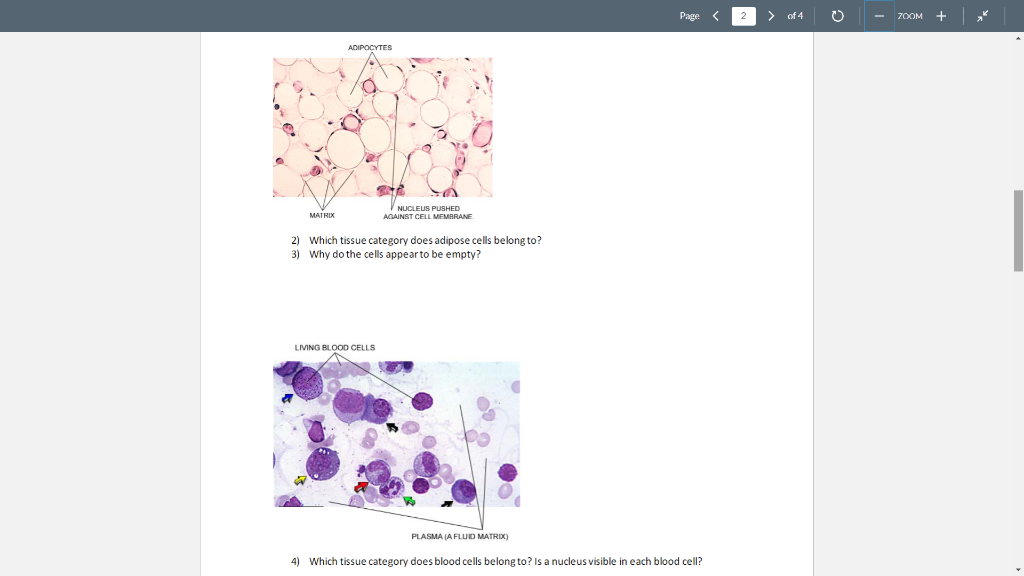 Solved > of 4 ZOOM + ADIPOCYTES . MATRIX NUCLEUS PUSHED | Chegg.com