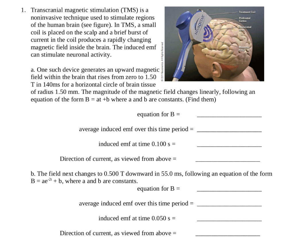 Solved Treatment Coil Prefrontal Cortex Transcranial | Chegg.com