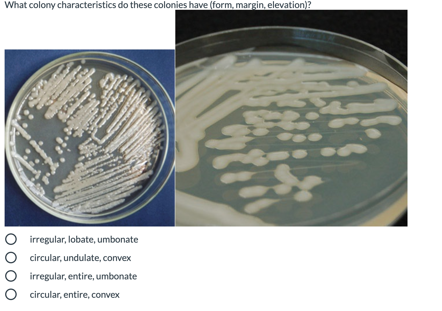 Solved What colony characteristics do these colonies have | Chegg.com