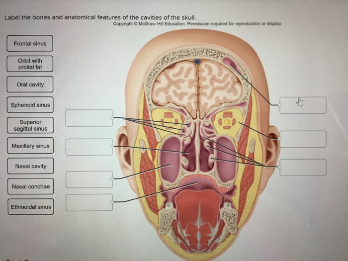 Solved Label The Bones And Anatomical Features Of The Cav Chegg