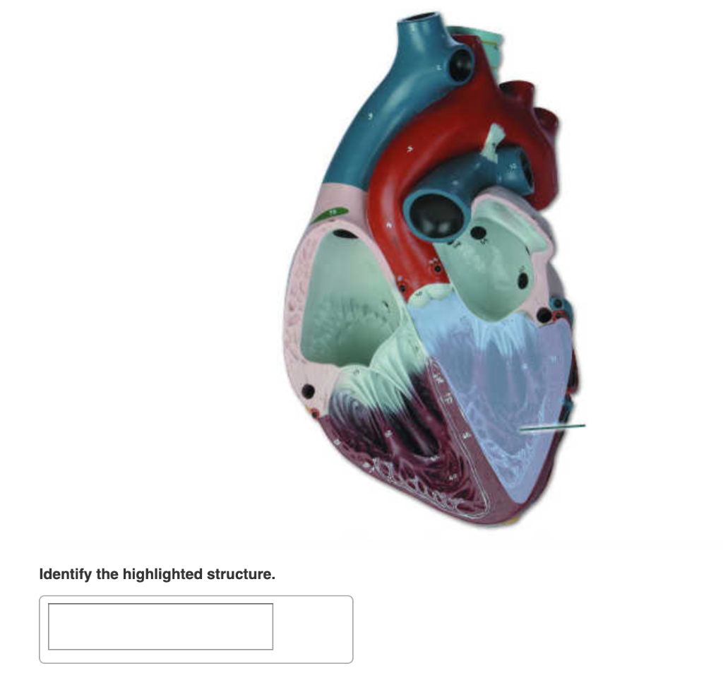 Solved LT-G12: Giant Heart, 4-part, 3B Scientific Identify | Chegg.com