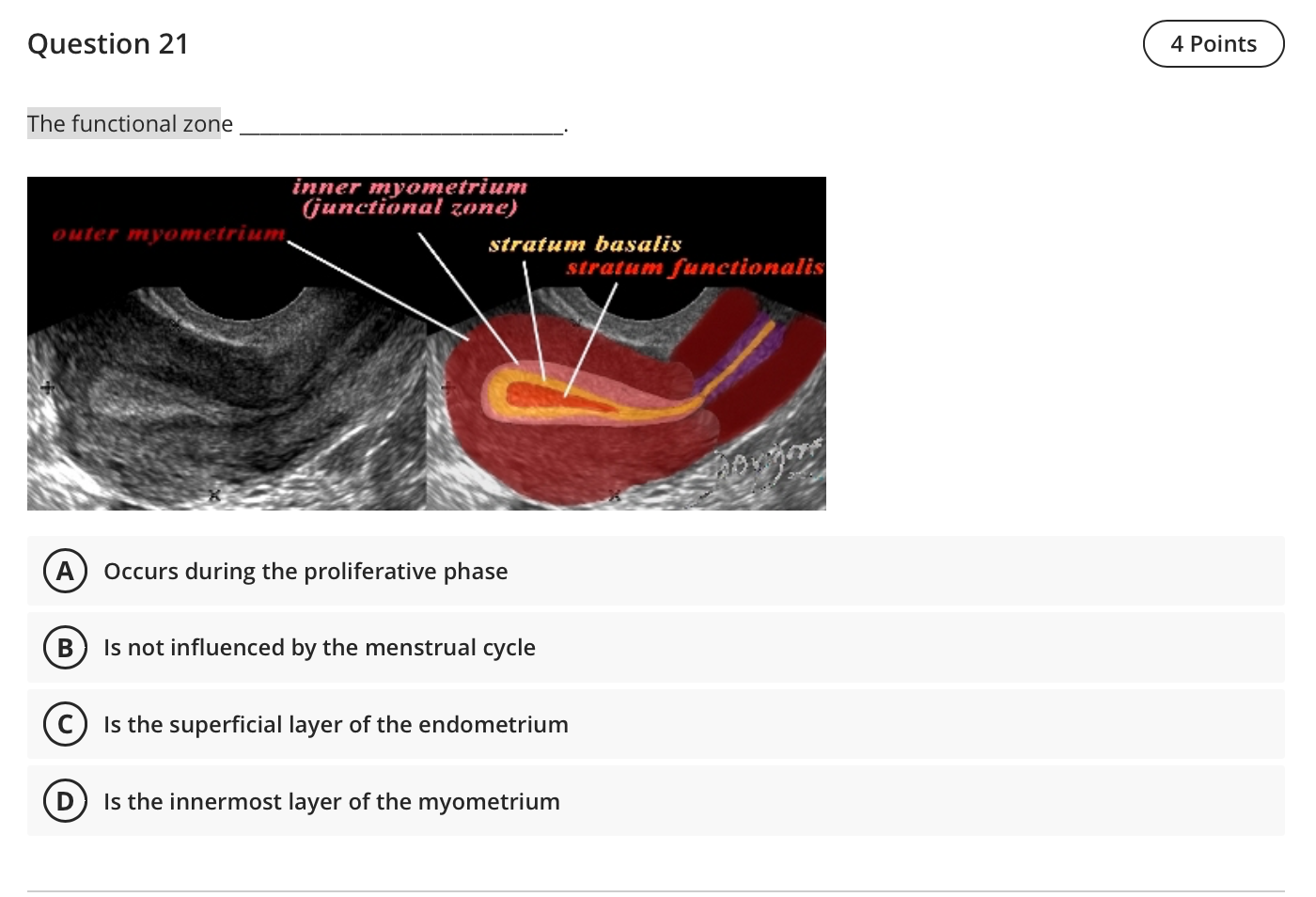 Solved Question 21 4 Points The functional zone outer | Chegg.com