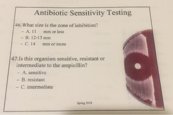 Solved Zone Size Interpretive Chart Inbibition Zone Diametor | Chegg.com