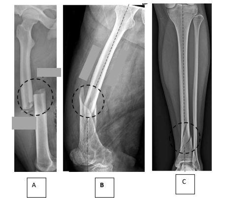 Solved Mechanics of Materials problem. Several long bone | Chegg.com