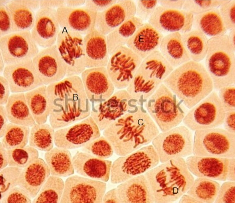 Solved Label the stages of mitosis | Chegg.com