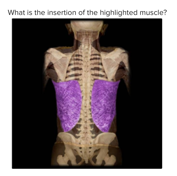 Solved What is the insertion of the highlighted muscle? | Chegg.com