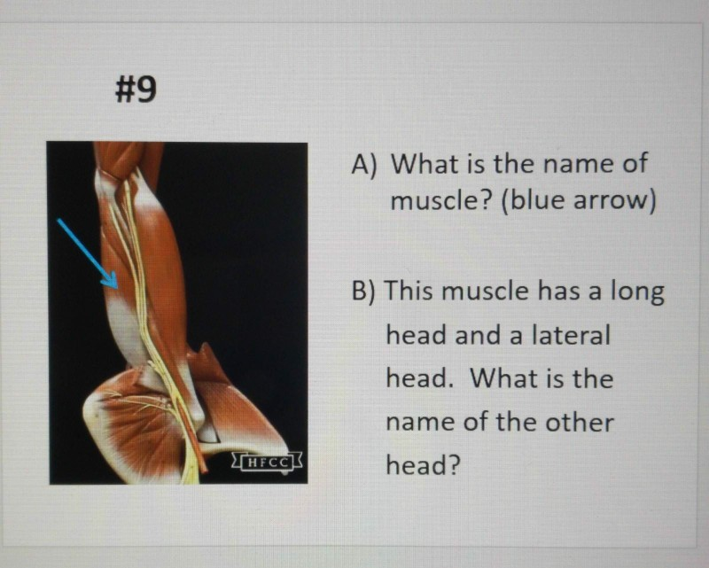 Solved #6 Name the muscles A) Blue arrow B) Yellow star | Chegg.com