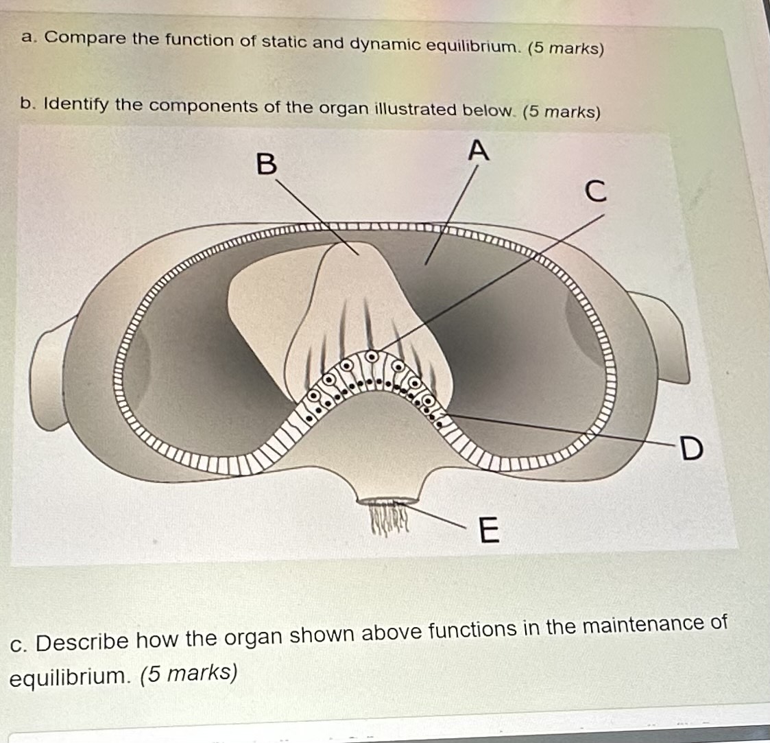 Solved a. ﻿Compare the function of static and dynamic | Chegg.com