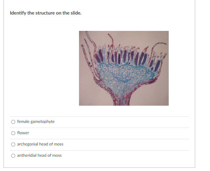 Solved Identify the structure on the slide. QUAD female | Chegg.com