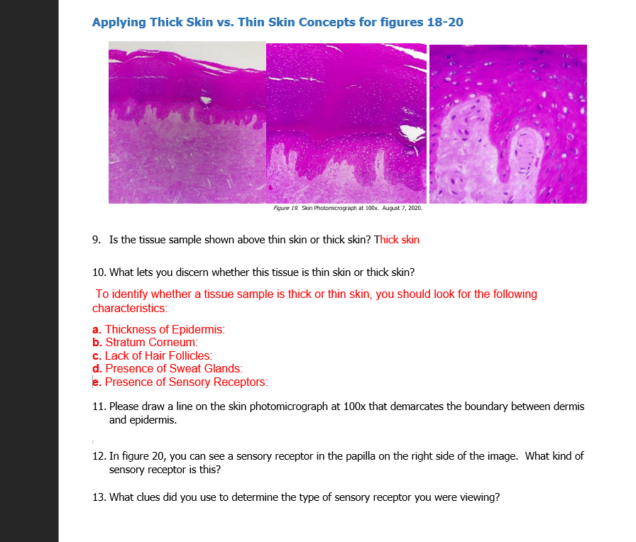 Solved Applying Thick Skin vs. Thin Skin Concepts for | Chegg.com