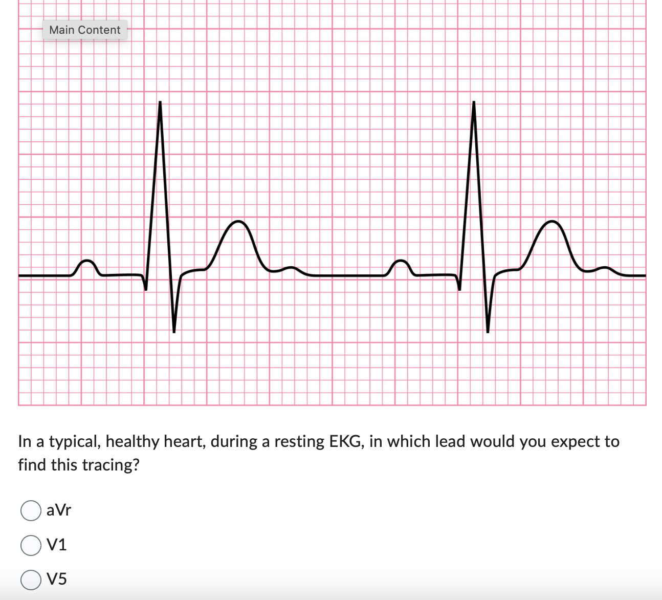 Solved In a typical, healthy heart, during a resting EKG, in | Chegg.com