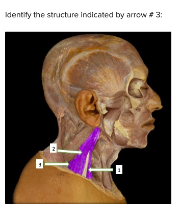 Solved Identify the structure indicated by arrow # 3: N 3 1 | Chegg.com