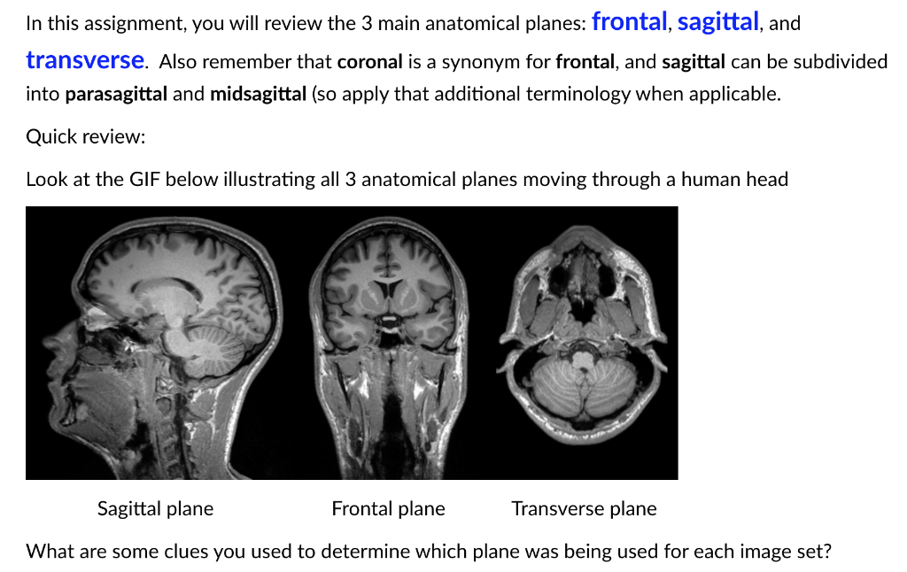 Solved In this assignment, you will review the 3 main | Chegg.com