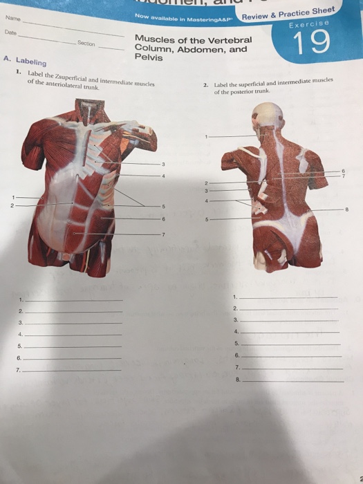 Solved: A. Labeling 1) Label The Zsuperficial And Intermed... | Chegg.com