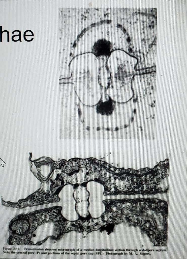 Solved 1. Draw a diagram of the Basidiomycota mushroom. 2. | Chegg.com