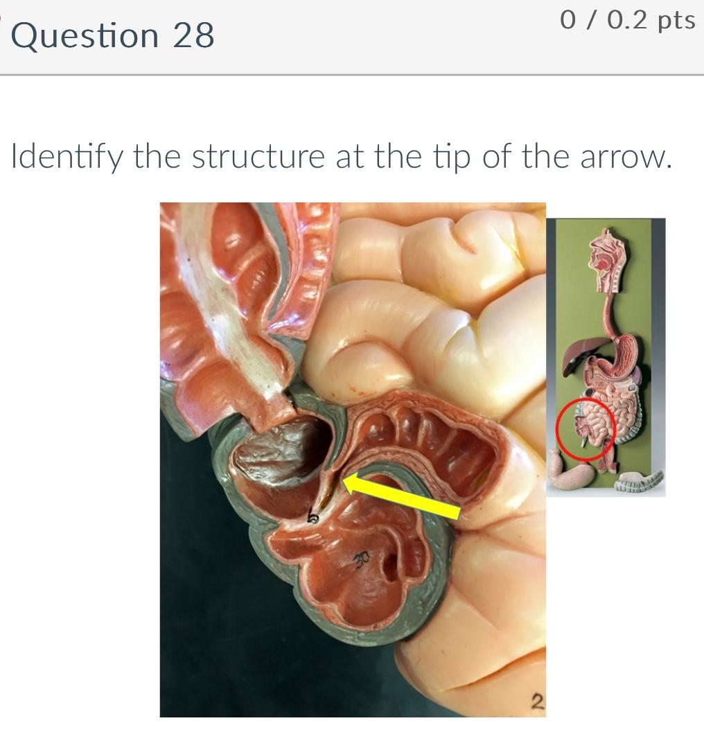 Solved Identify the structure at the tip of the | Chegg.com