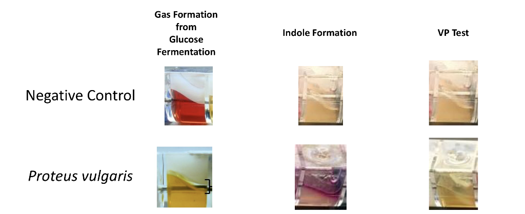Solved Lysine H,S Lactose Sorbitol Glucose Ornithine | Chegg.com