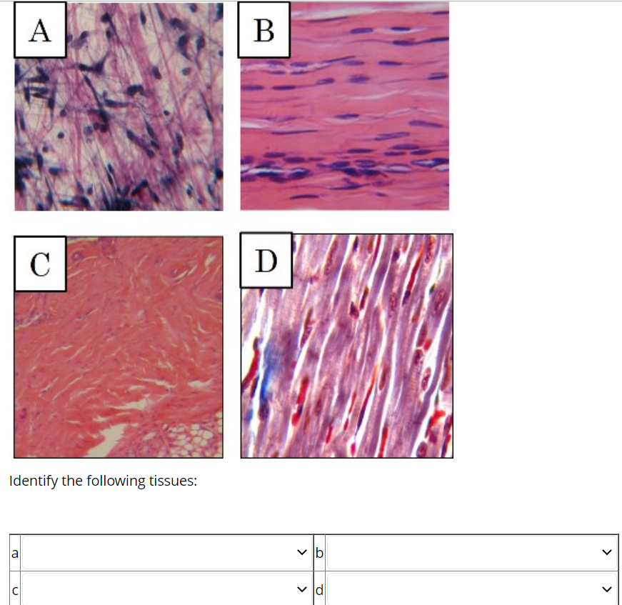 Solved A B С D Identify the following tissues: a b с > d > | Chegg.com
