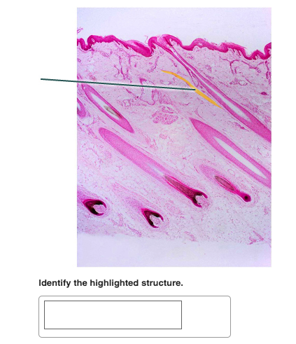 Solved Identify the highlighted structure. | Chegg.com