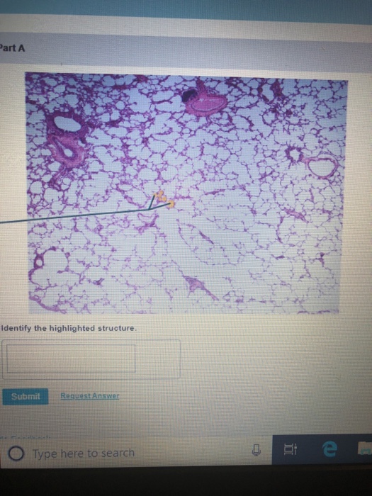 Solved art A Identify the highlighted structure Submit Type | Chegg.com