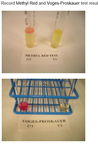 7. Record results for glucose, lactose, sucrose, and | Chegg.com