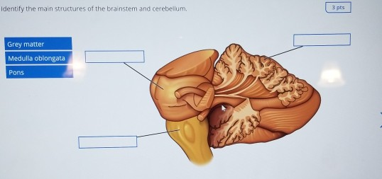 Solved Identify the main structures of the brainstem and | Chegg.com
