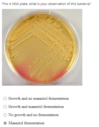 Solved This is MSA plate, what is your observation of this | Chegg.com