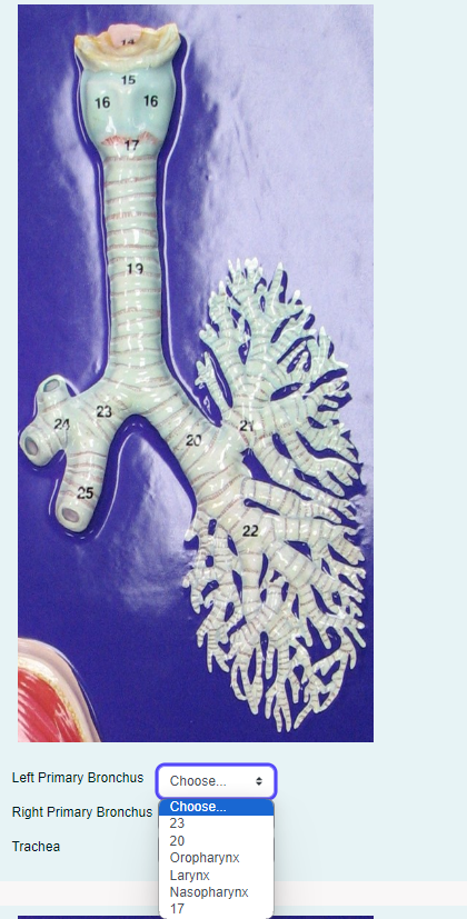 Solved Left Primary Bronchus Right Primary Bronchus Trachea | Chegg.com
