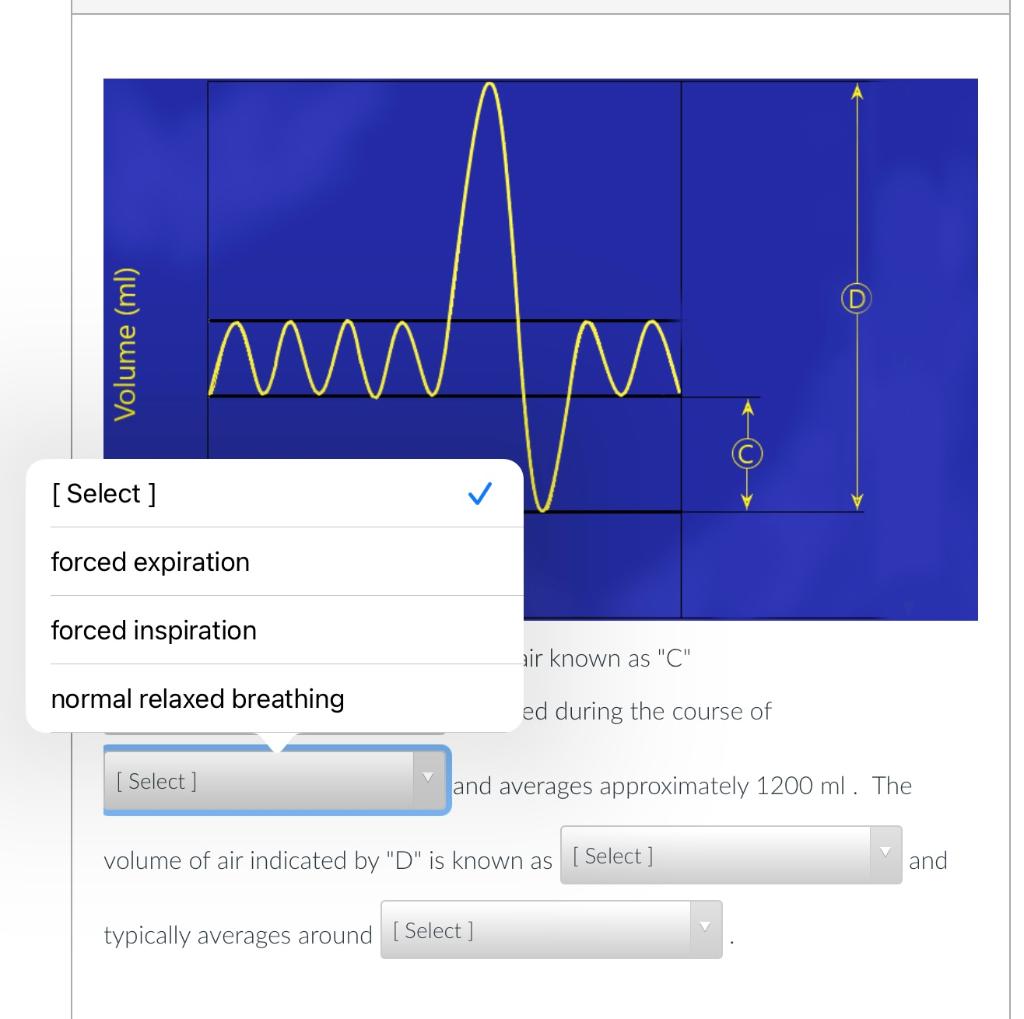 Solved Volume (ml) MW m In the spirogram above, the volume | Chegg.com