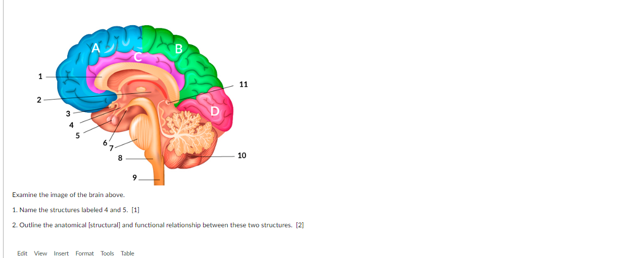 Solved Examine the image of the brain above. 1. Name the | Chegg.com