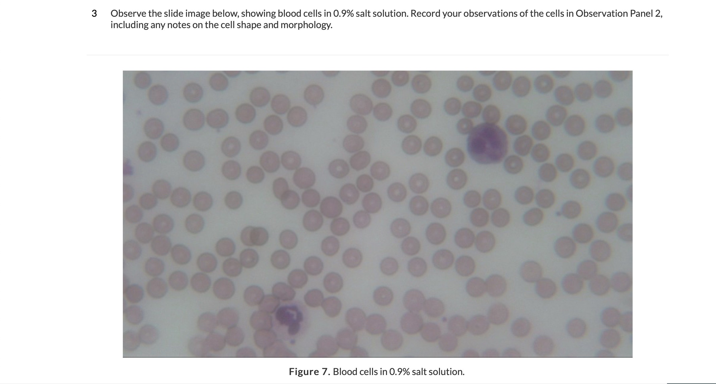 Observe the slide image below, showing blood cells in | Chegg.com