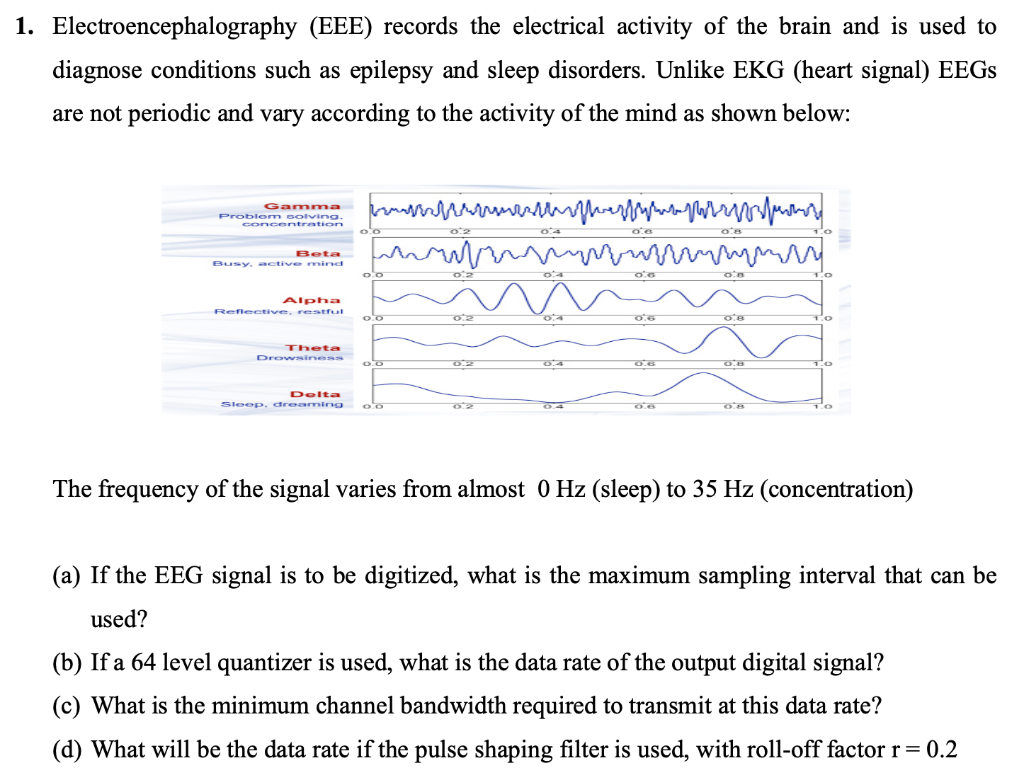 Solved 1. Electroencephalography (EEE) records the | Chegg.com
